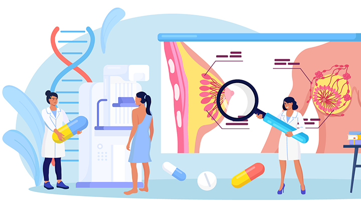 Diferença entre cisto e nódulos mamários