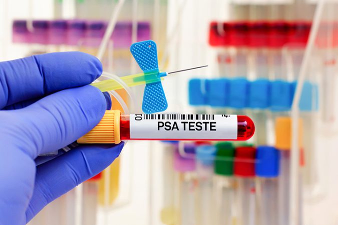 Exame PSA: para que serve, preparo e como é feito