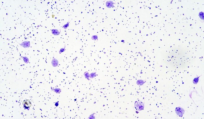 Giardíase: sintomas, transmissão e tratamento | Blog Nav Dasa