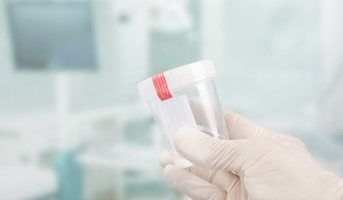 Espermograma: o que é, como é feito e preparação | Blog Nav Dasa