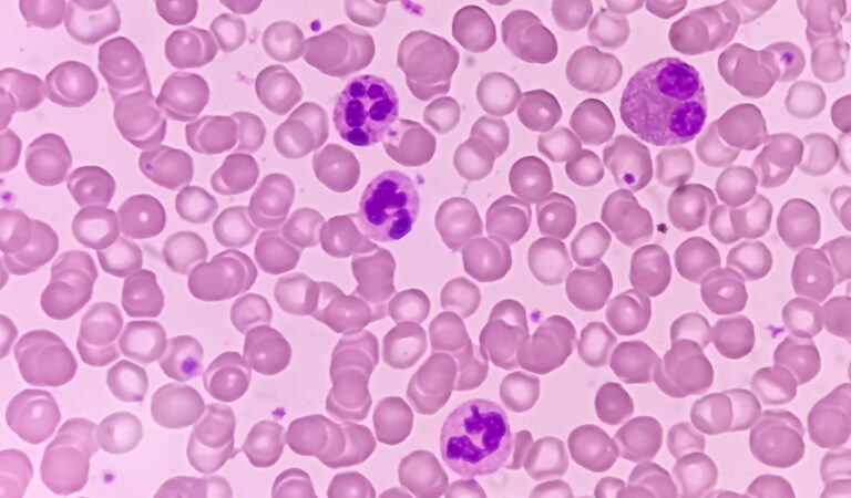 Eosinófilos alto e baixo: o que pode ser? | Blog Nav Dasa