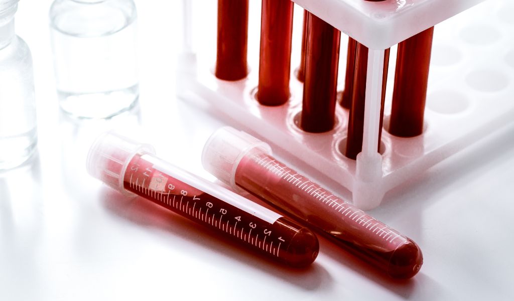 Mioglobina: o que é e para que serve o exame | Blog Nav Dasa