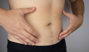 Ascite: causas, sintomas e tratamento | Nav Dasa