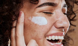 Melasma: o que é, causas e tratamentos