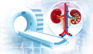 Hidronefrose: sintomas, diagnóstico e tratamento | Nav Dasa