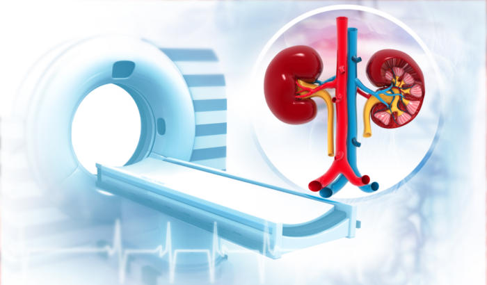 Hidronefrose: sintomas, diagnóstico e tratamento | Nav Dasa