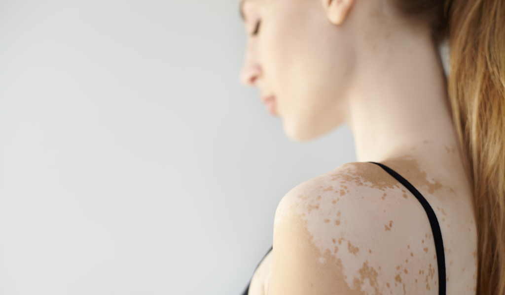 Qual exame de sangue detecta câncer? Entenda os marcadores tumorais